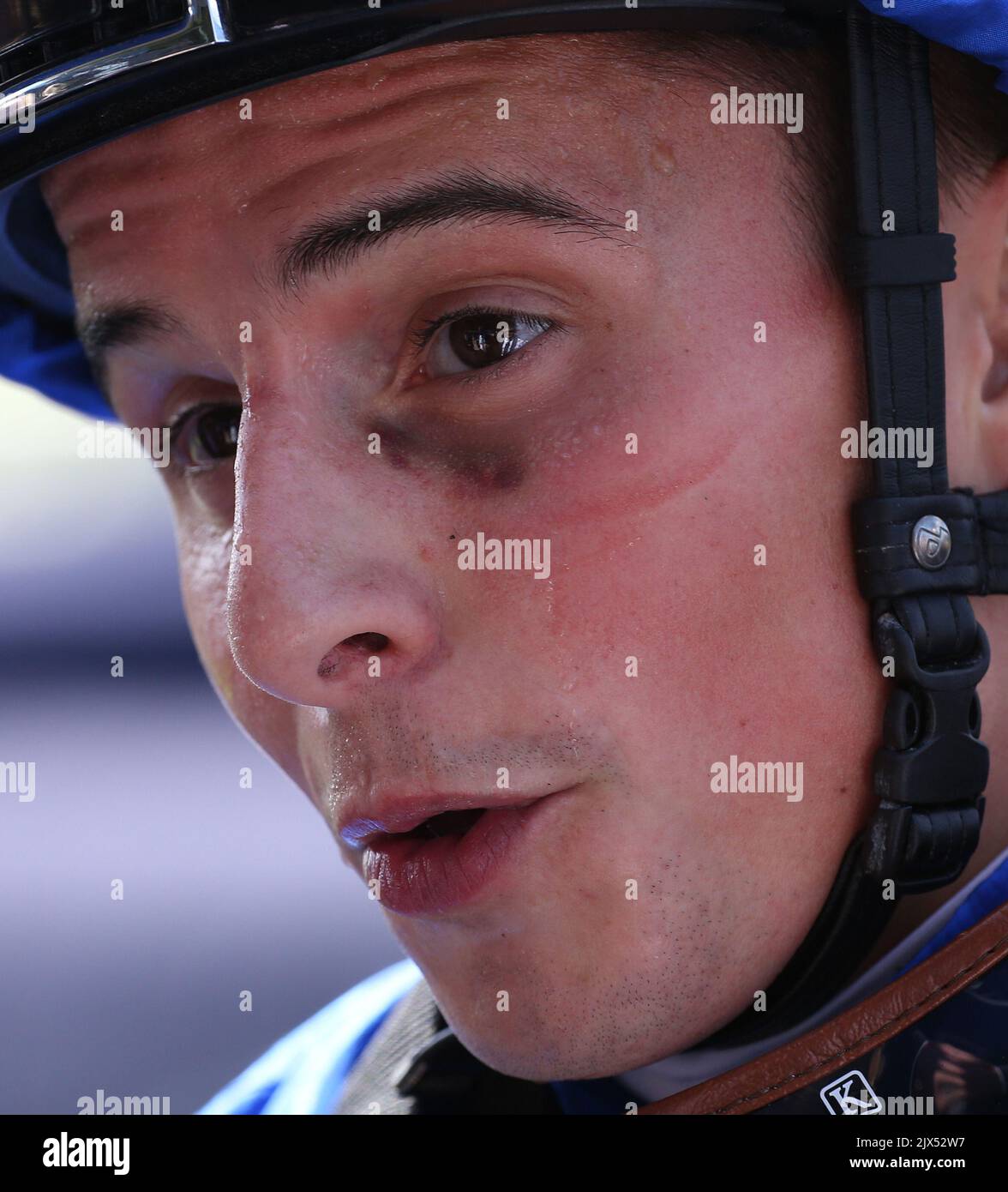 Jockey William Buick shows a black eye during Ladies Day at Rosehill ...