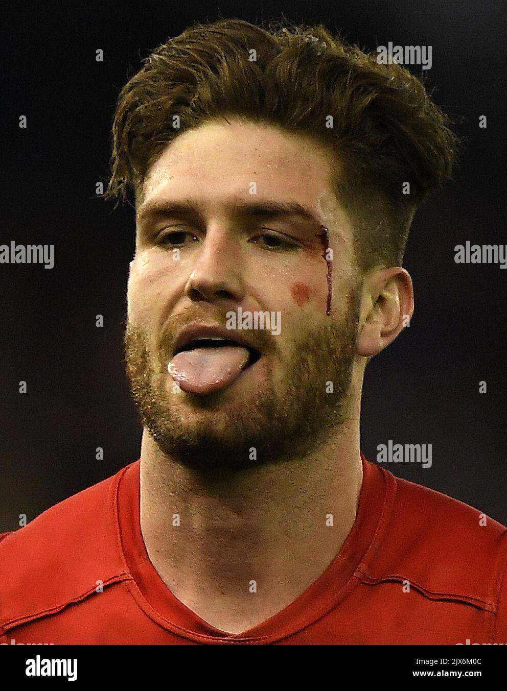 Tomas Bugg of the Demons is seen with blood on his face during the ...