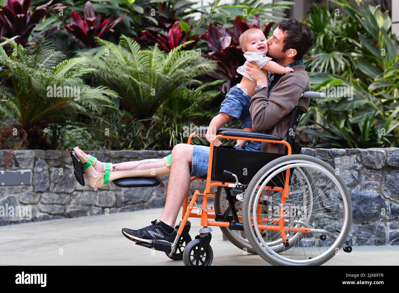 The world's first patient to receive a 3D-printed tibia transplant ...