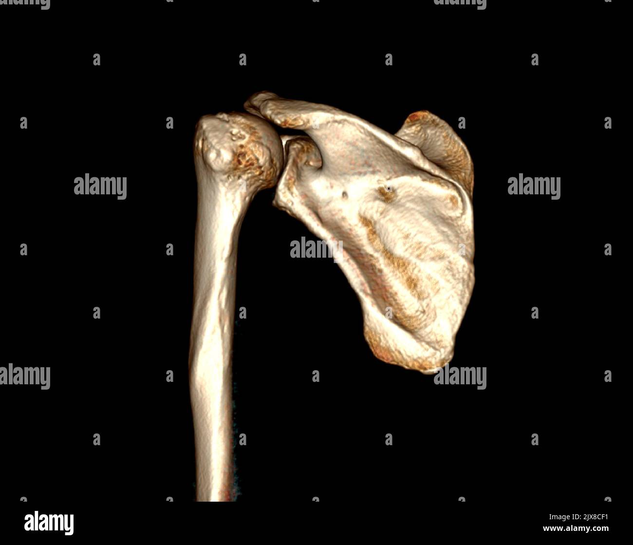 Computed Tomography Volume Rendering examination of the Shoulder 3D ...
