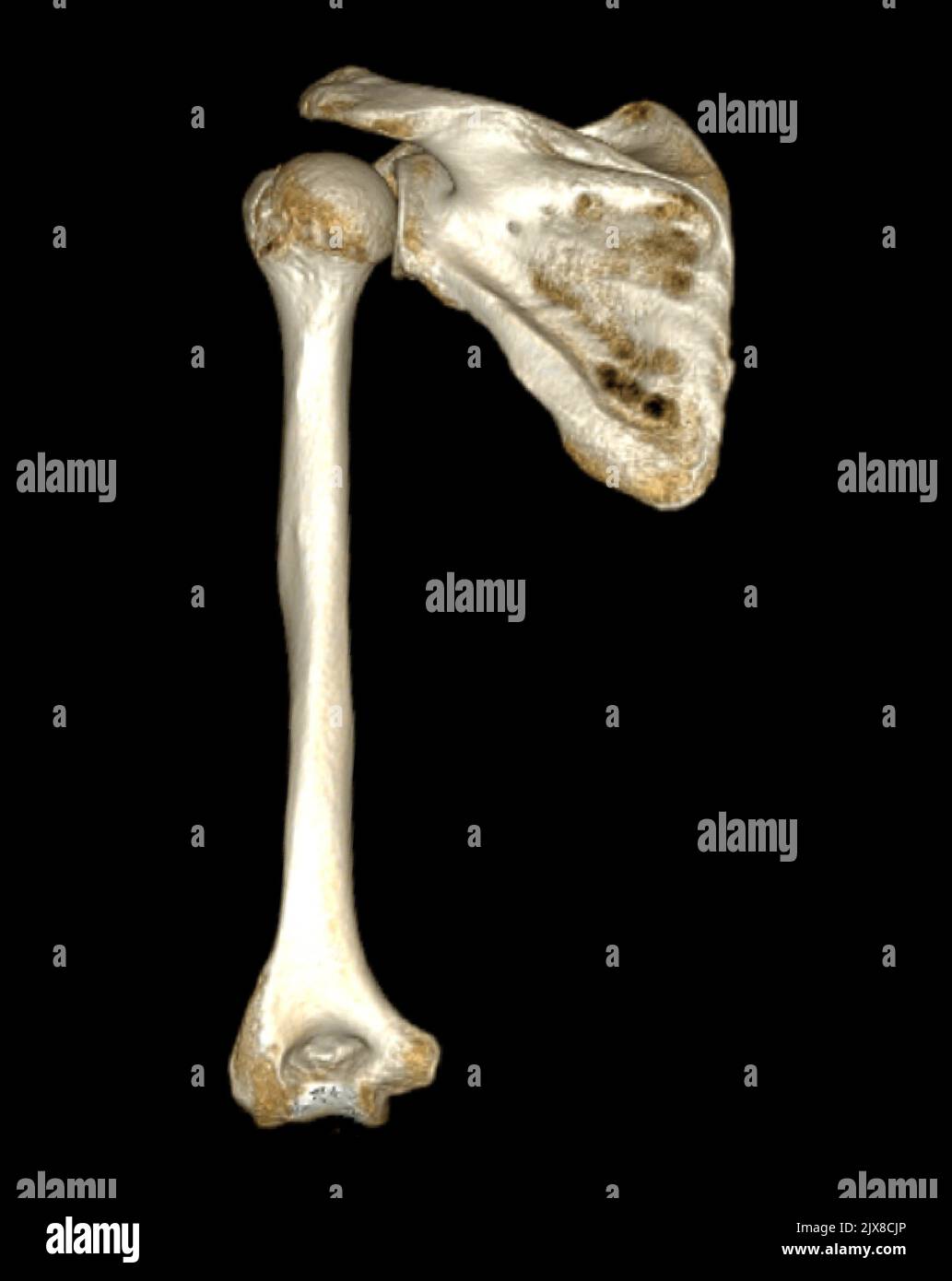 Computed Tomography Volume Rendering examination of the shoulder joint ...