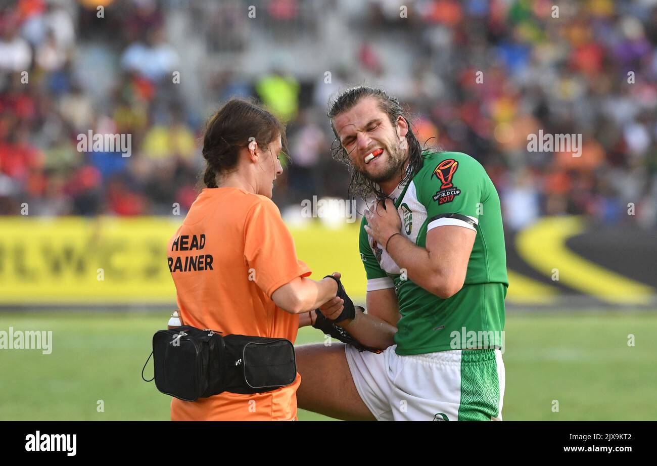 Ireland's Liam Kay receives treatment in the Rugby League World Cup ...
