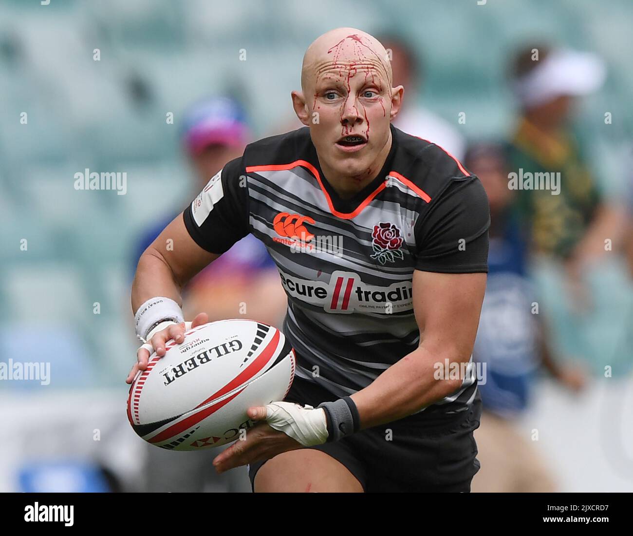 Blood pours down the face of Alex Matthews of England as she runs with ...
