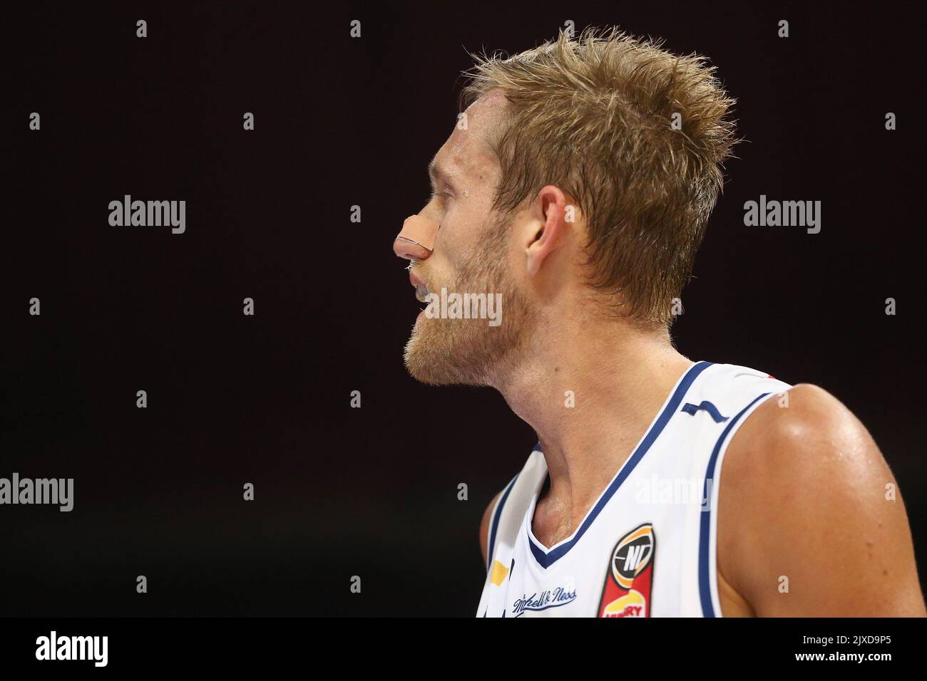 Mitchell Young of the Bullets looks on with a nose injury during the ...