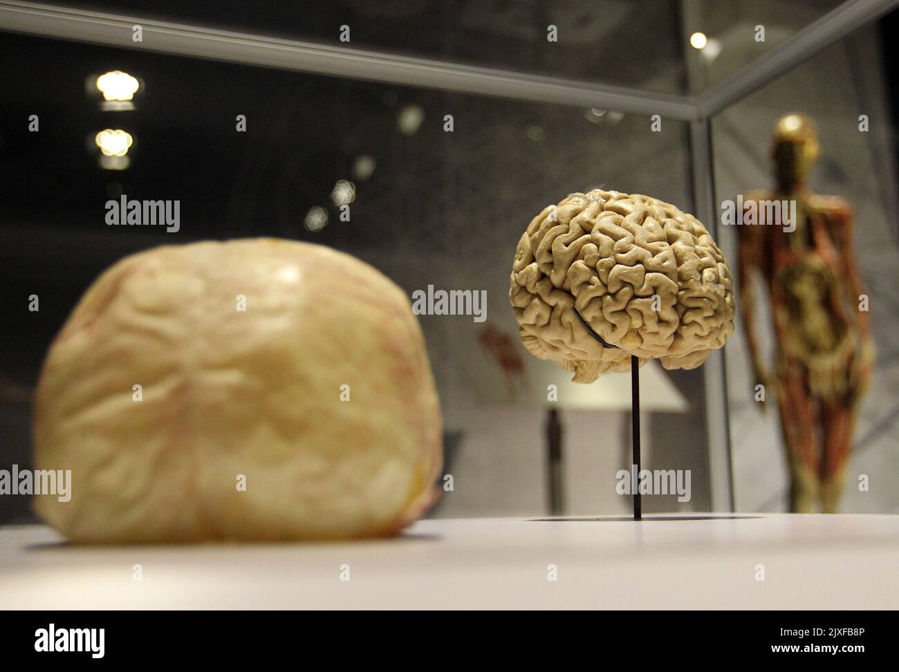 A human brain is seen at Real Bodies The Exhibition at Byron Kennedy ...