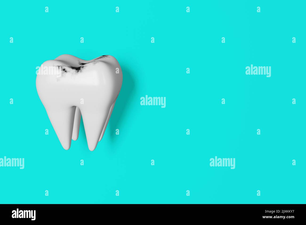 Caries tooth anatomy model 3D rendering. Sick unhealthy molar on blue ...