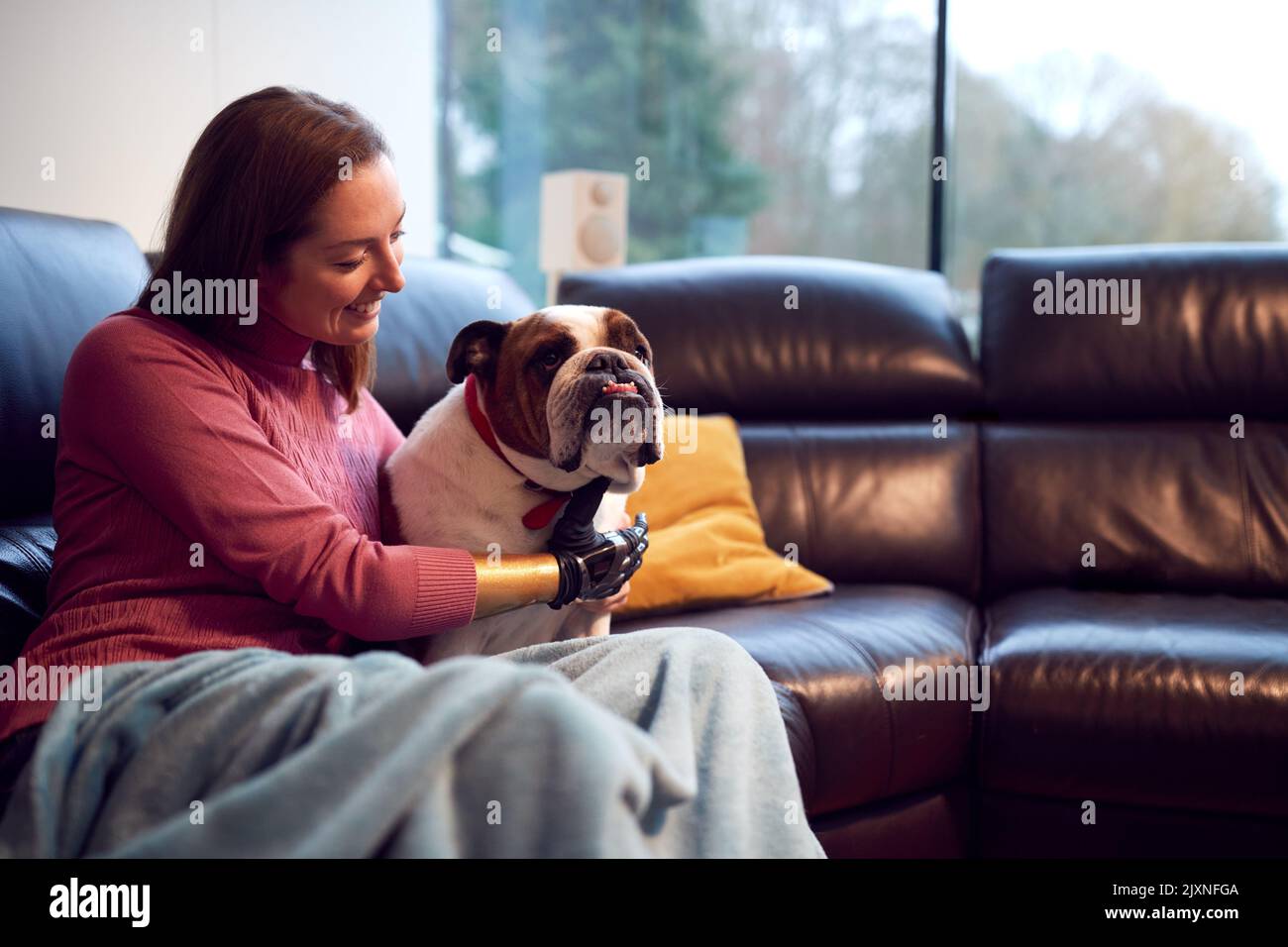Prosthetic arm cup hi-res stock photography and images - Alamy