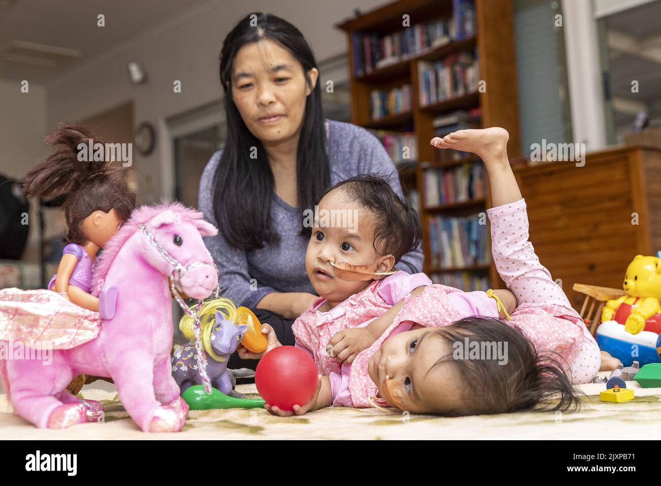 Conjoined twins Nima and Dawa, with their mother, Bhumchu Zangmo, at ...
