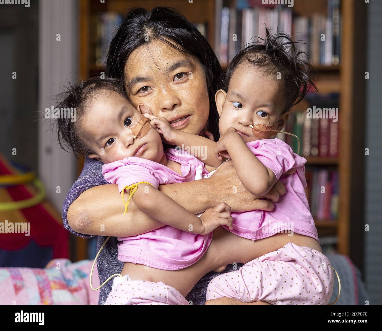 Bhumchu Zangmo is seen holding her conjoined twins Nima and Dawa at ...