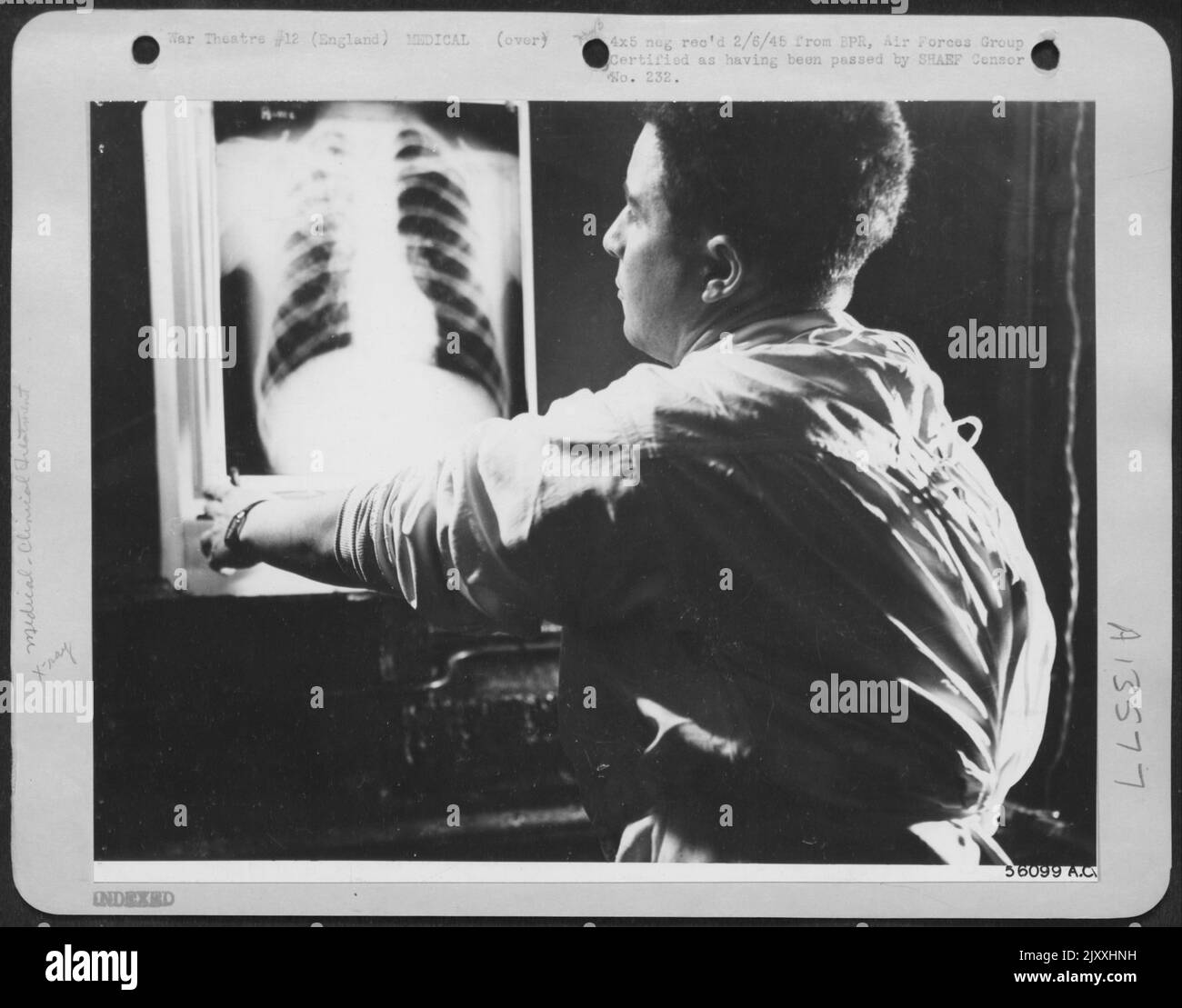 A doctor inspects the results of an X-ray plate made of the chest of a ...