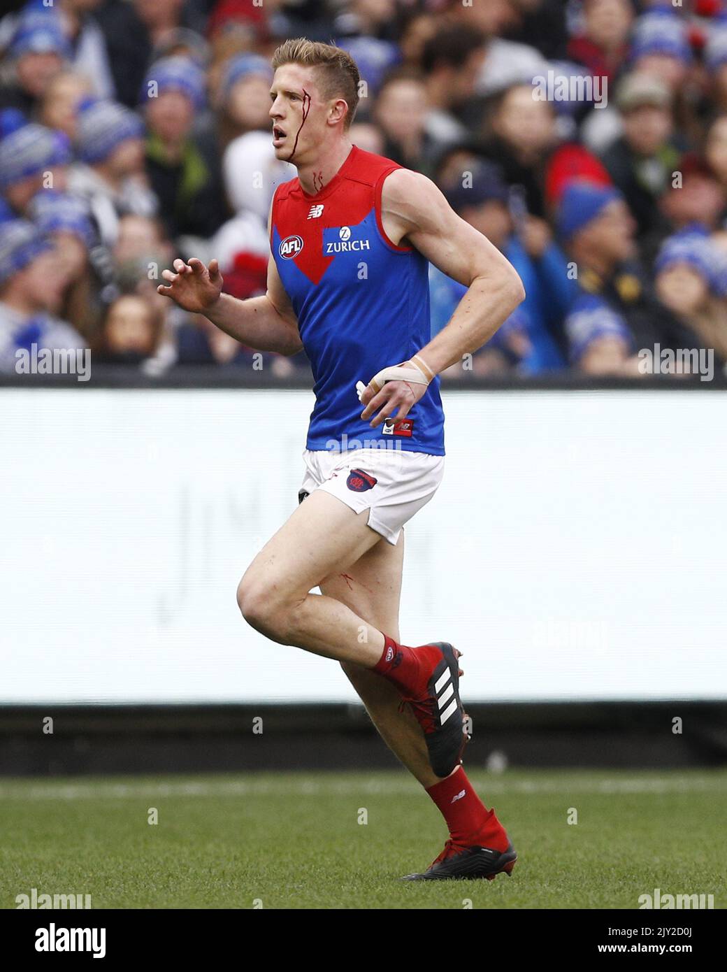 Sam Frost of the Demons runs off bleeding from the face during the ...