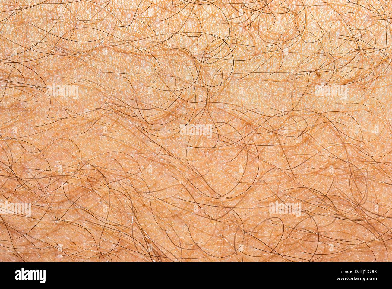 Texture of human skin covered with hair Stock Photo - Alamy