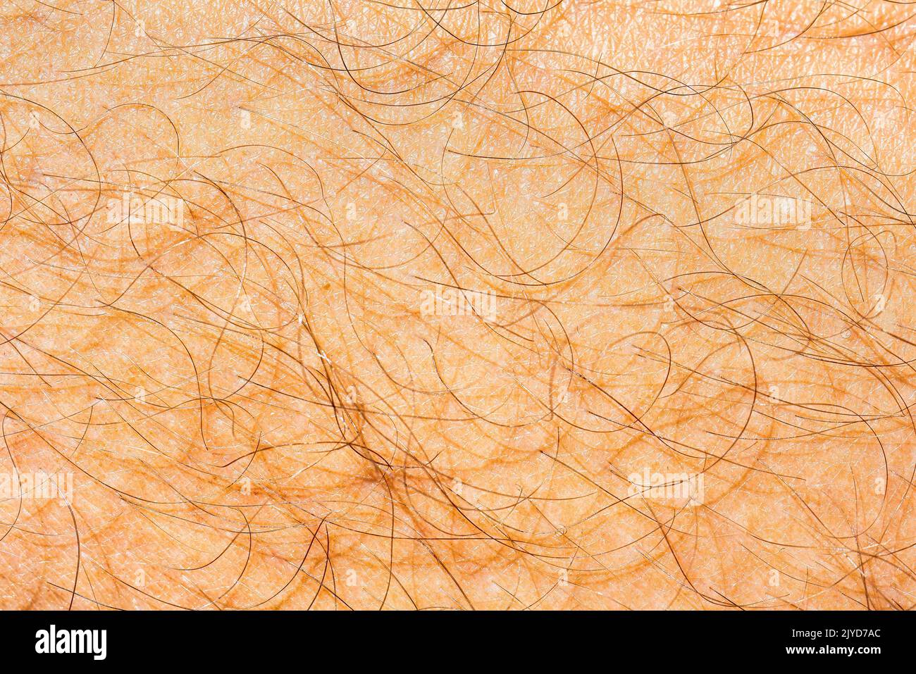 Texture of human skin covered with hair Stock Photo - Alamy