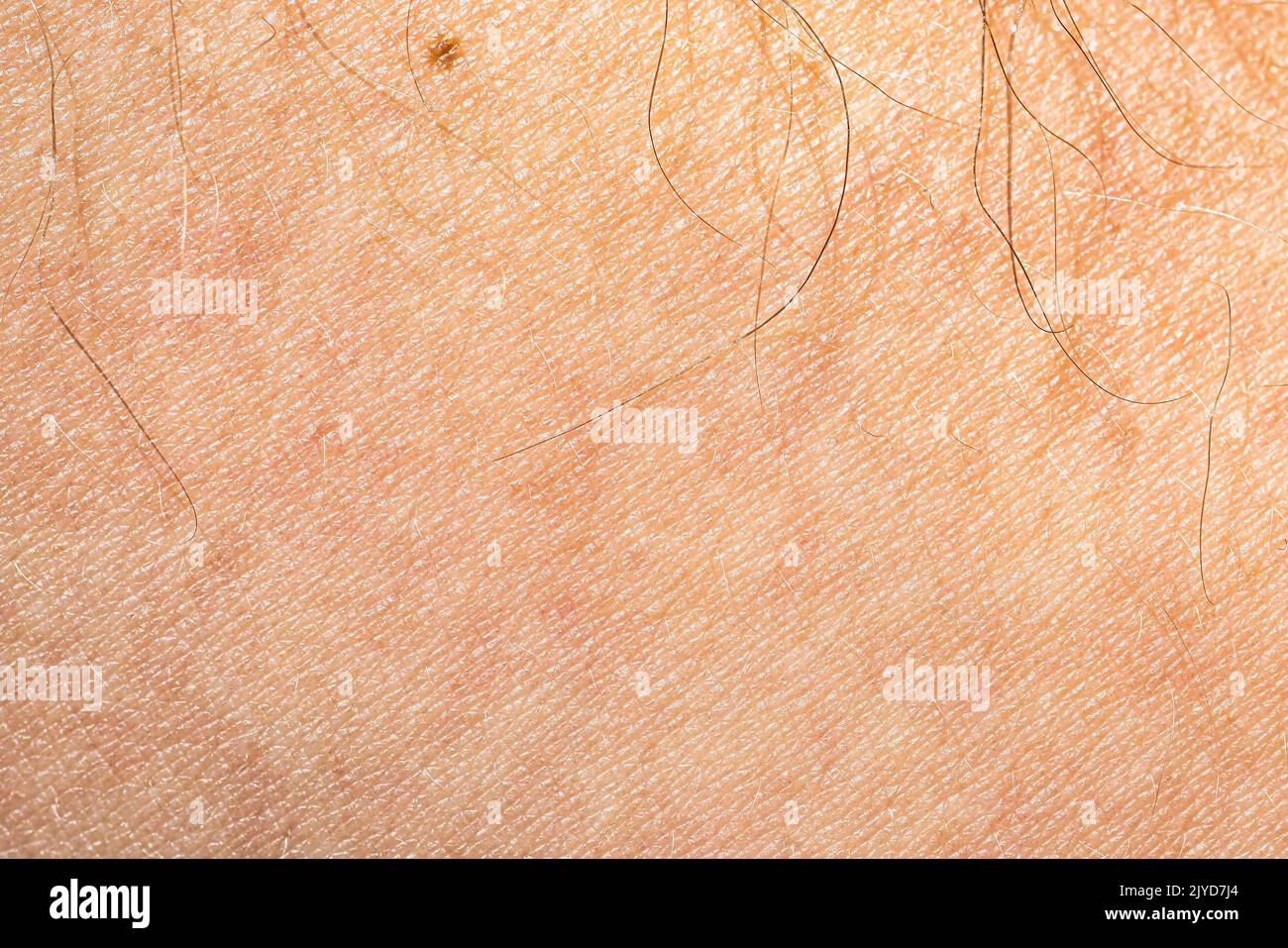 Texture of human skin covered with hair Stock Photo - Alamy