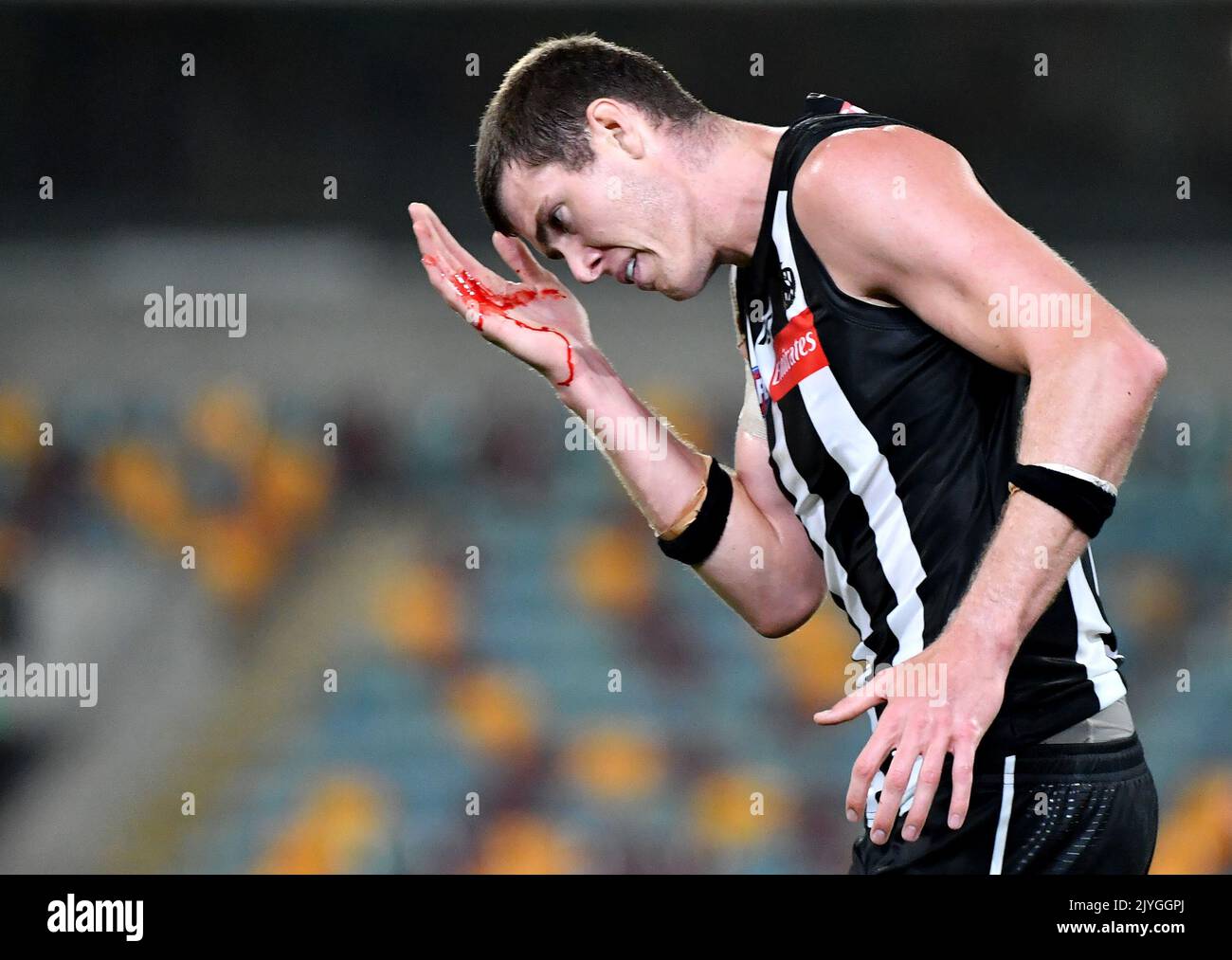 Mason Cox of the Magpies is seen bleeding from an injury during the ...