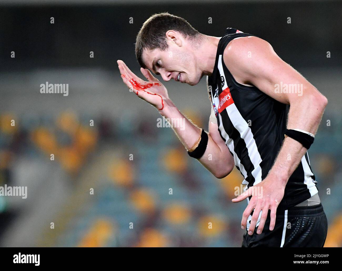 Mason Cox of the Magpies is seen bleeding from an injury during the ...