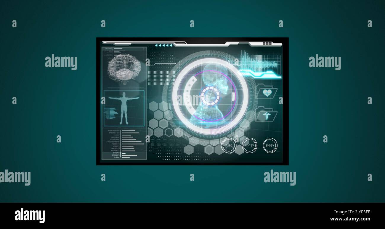 Image of scopes scanning and medical data processing over digital screen Stock Photo - Alamy