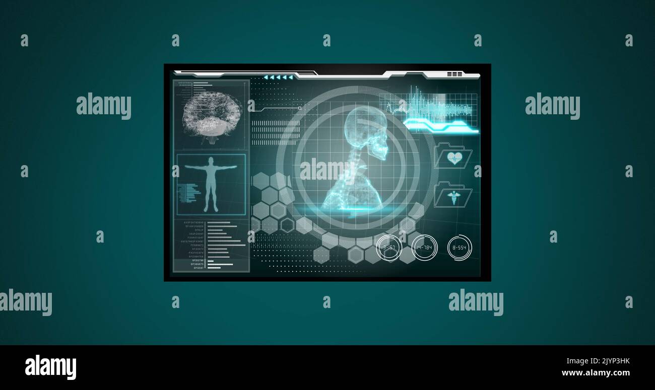 Image of scopes scanning and medical data processing over digital ...