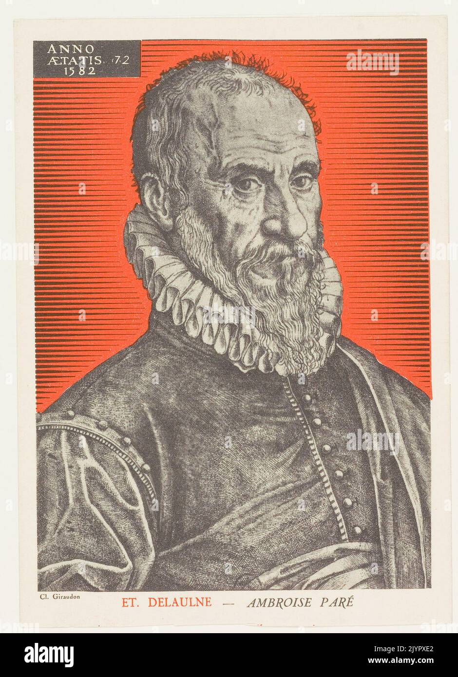 Ambroise Paré was a 16th-century French surgeon and one of the pioneers ...