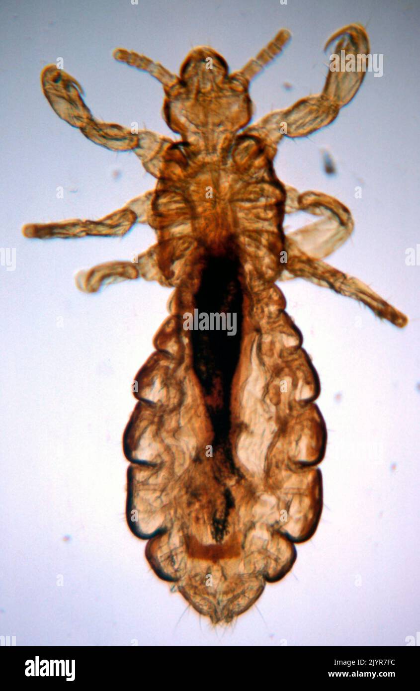 Head louse (Pediculus humanus Stock Photo - Alamy
