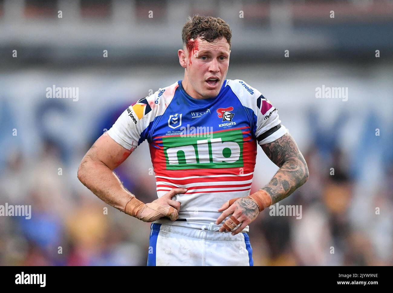 Kurt Mann of the Knights is seen bleeding from a head wound during the ...