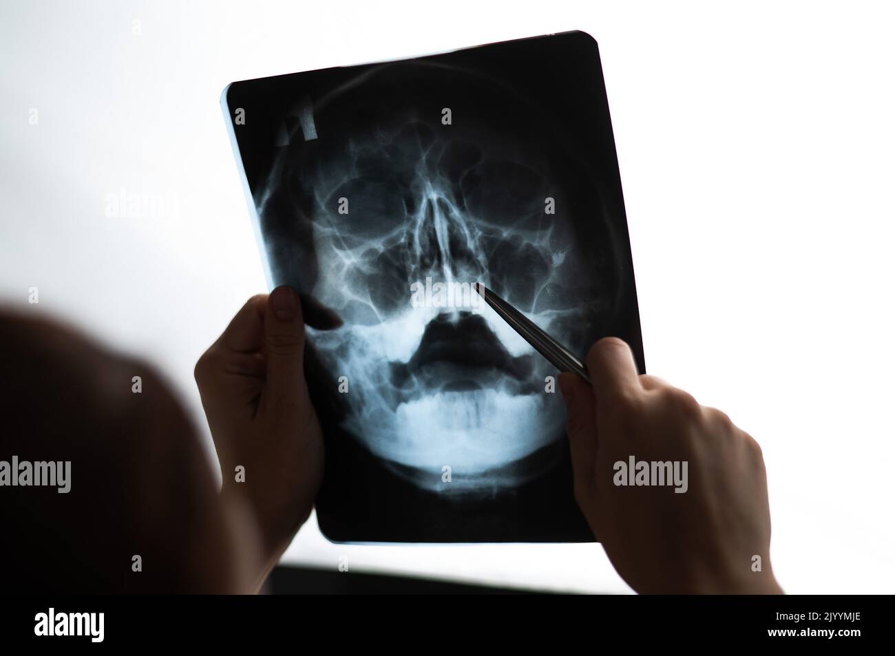 The doctor looks at the x-ray of the sinuses Stock Photo - Alamy