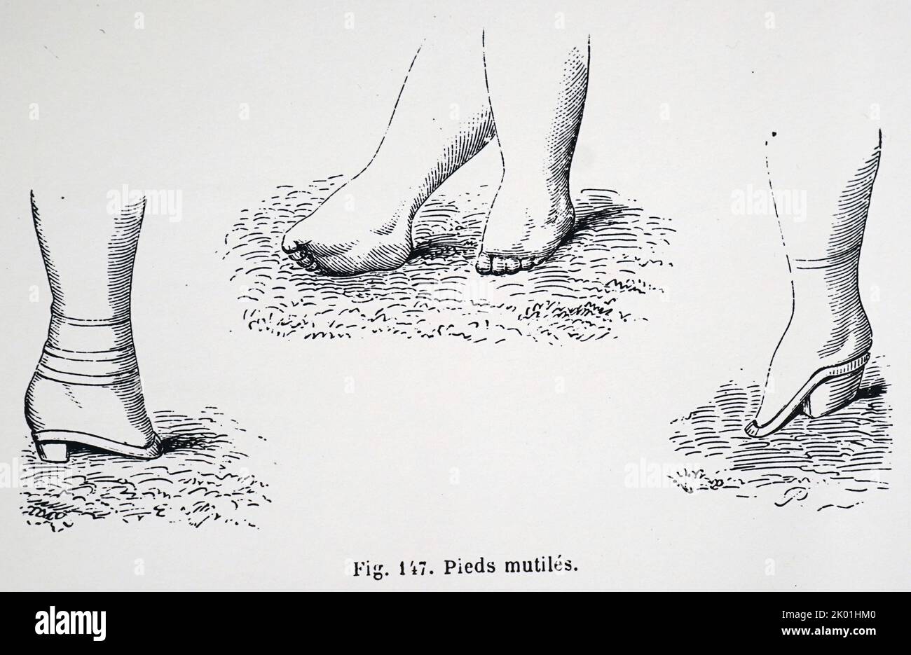Perfect Foot Binding