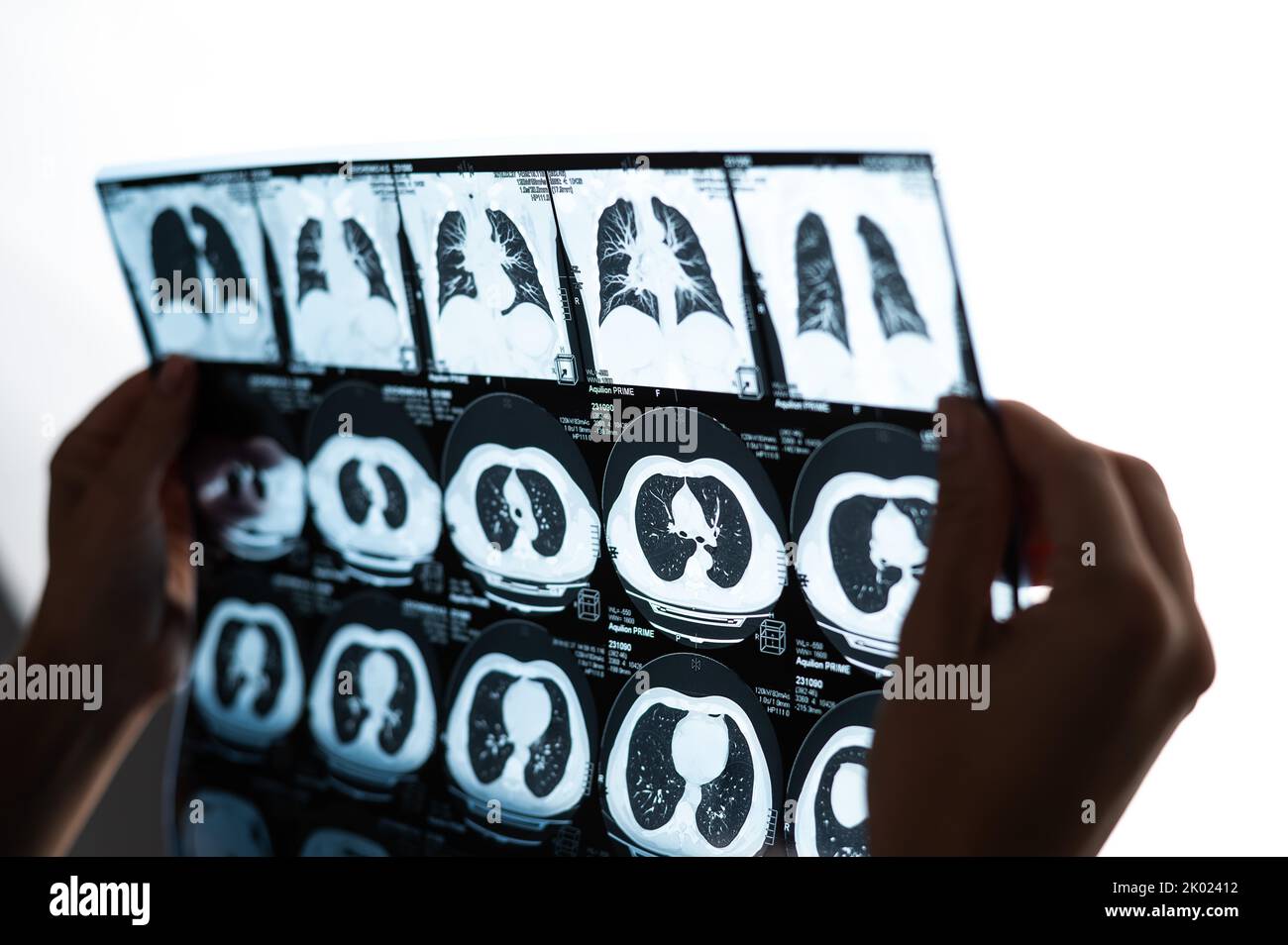 A female doctor examines an MRI scan of the internal organs. Abdomen ...