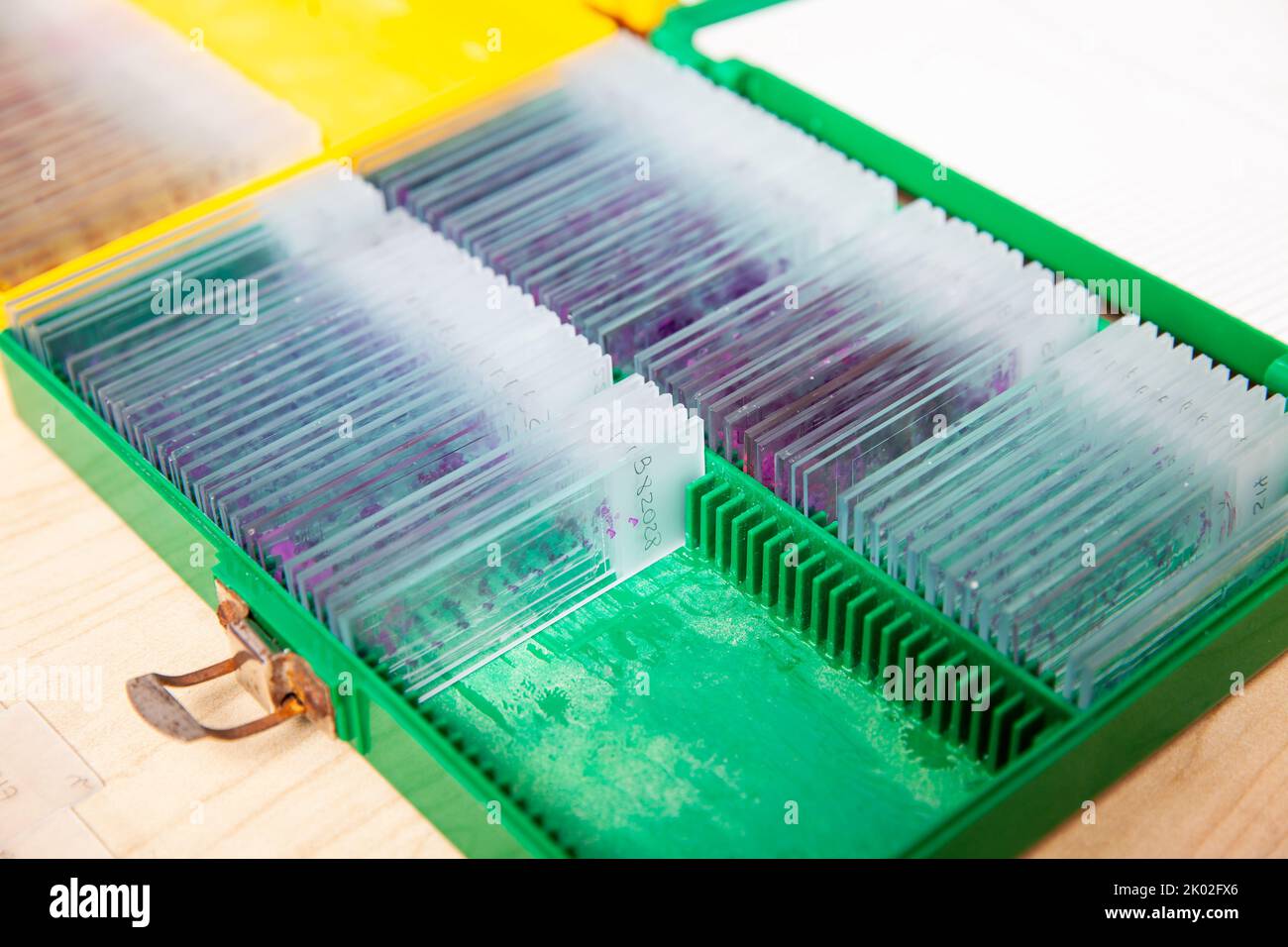 Box of stained tissue biopsy glass slides in pathology laboratory Stock ...