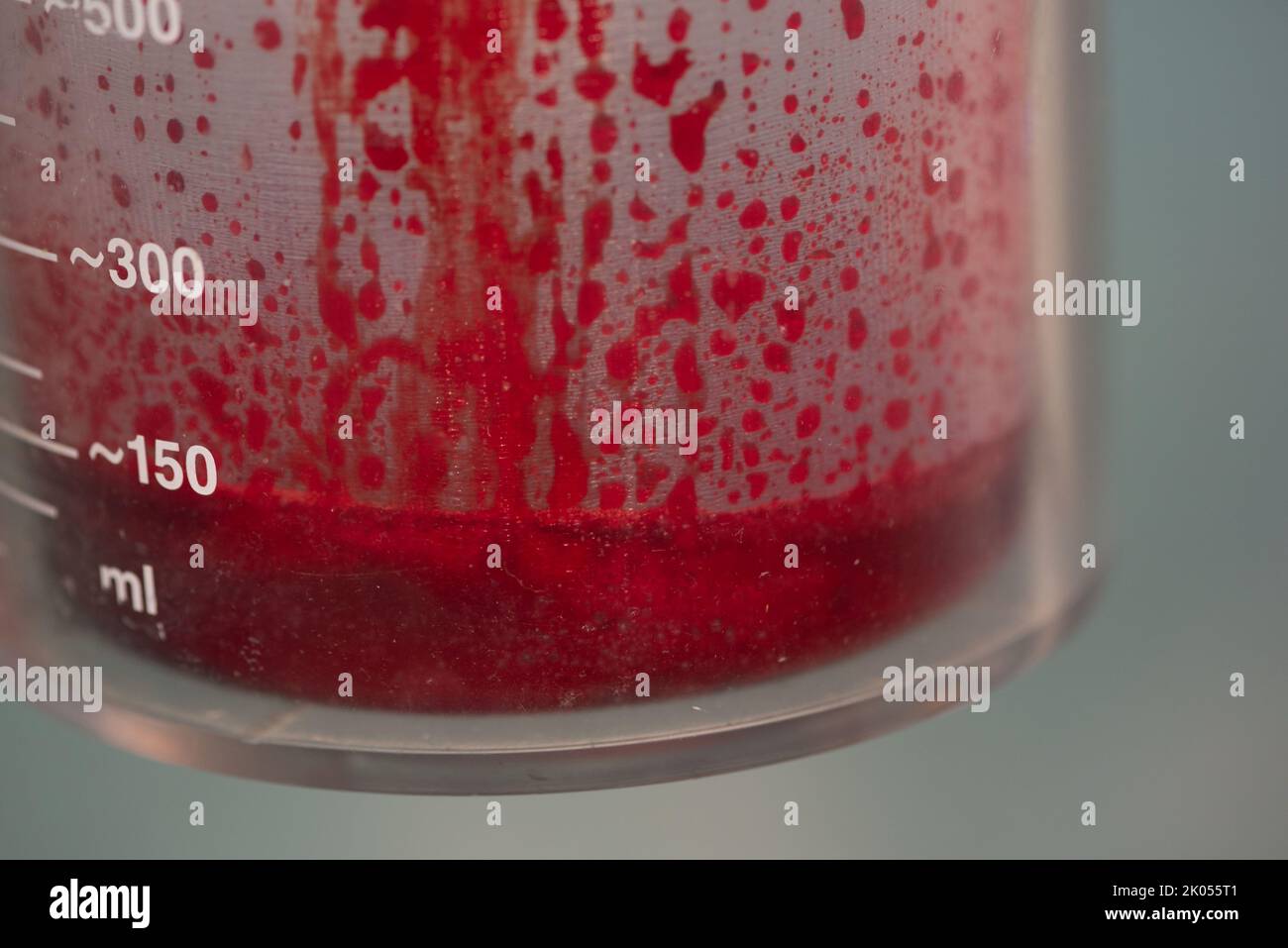 Close-up view of blood loss in surgical vacuum during operation in ...