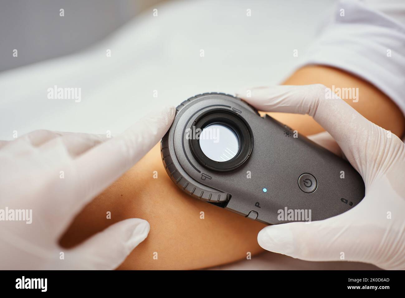 Dermatologist examines birthmark patient hi-res stock photography and ...