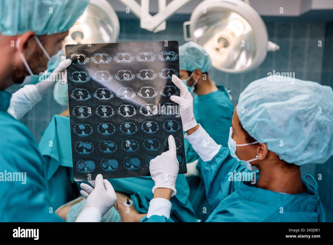 Medical doctors looking at x-rays in a hospital before operation ...