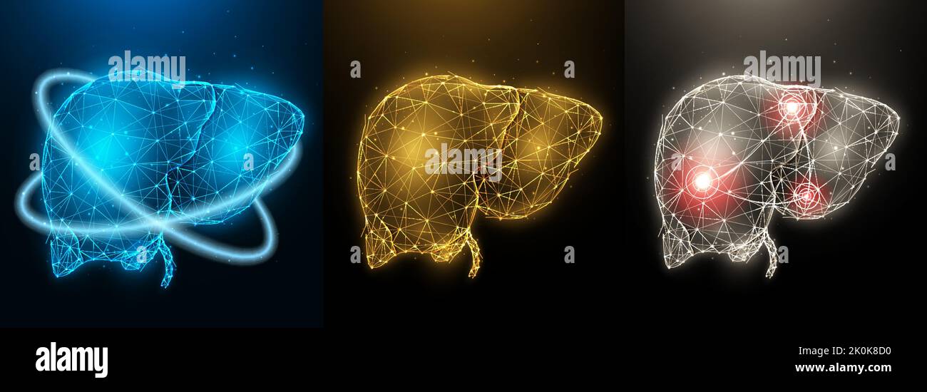 Polygonal vector illustration of inflamed diseased human liver, healthy ...