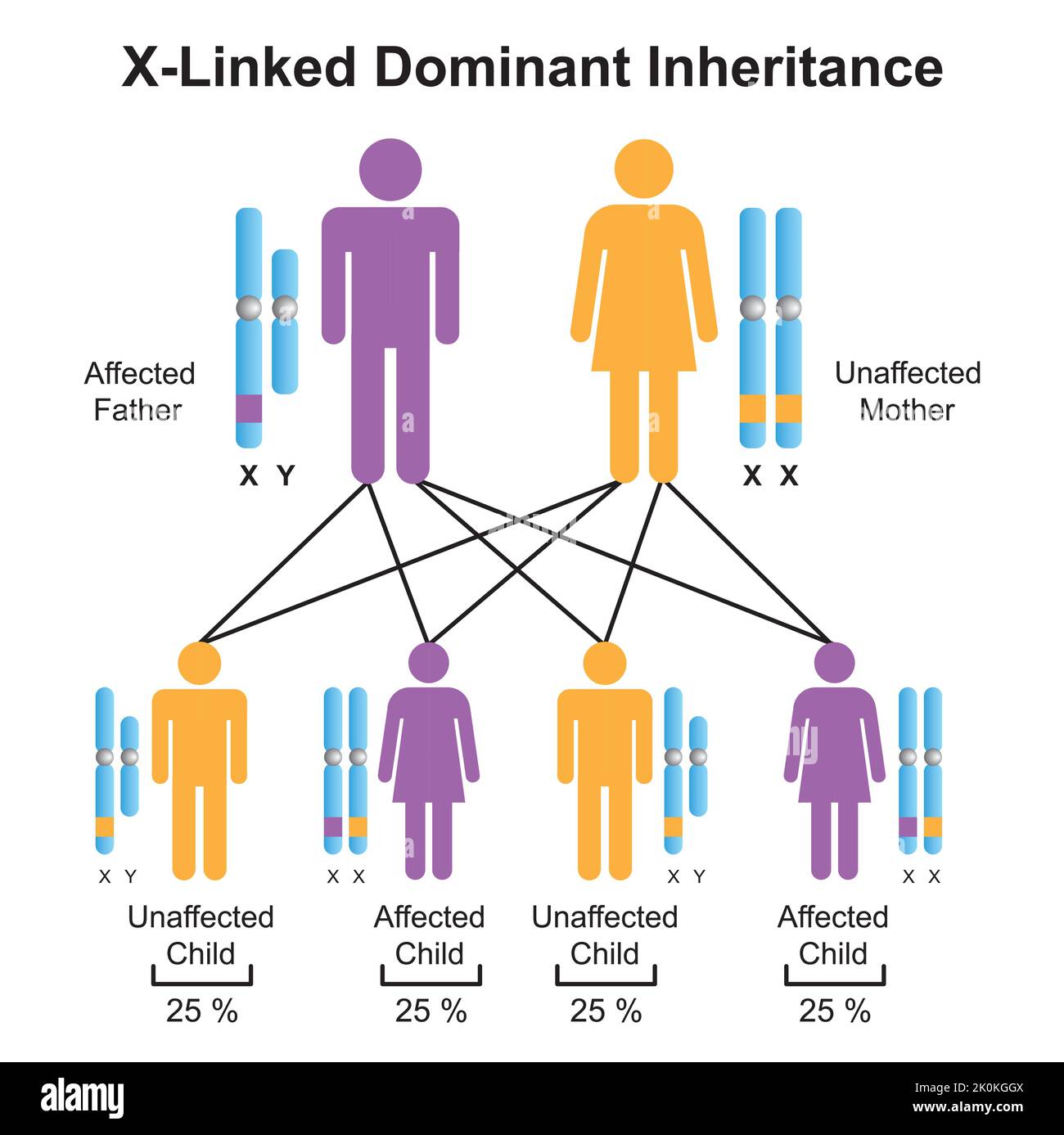Scientific Designing of X-Linked Dominant Inheritance. Colorful Symbols. Vector Illustration ...
