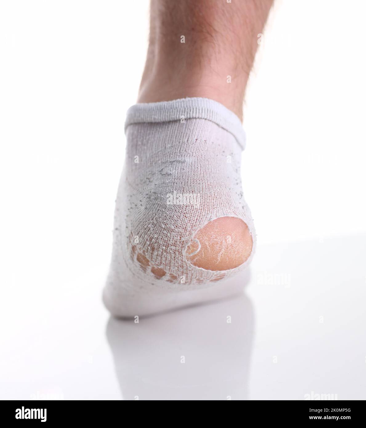 Torn fabric repair hi-res stock photography and images - Alamy