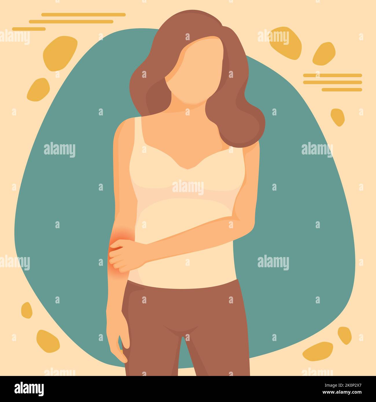 People scratch the itch with hand, Eczema, Arm, Concept with Healthcare ...