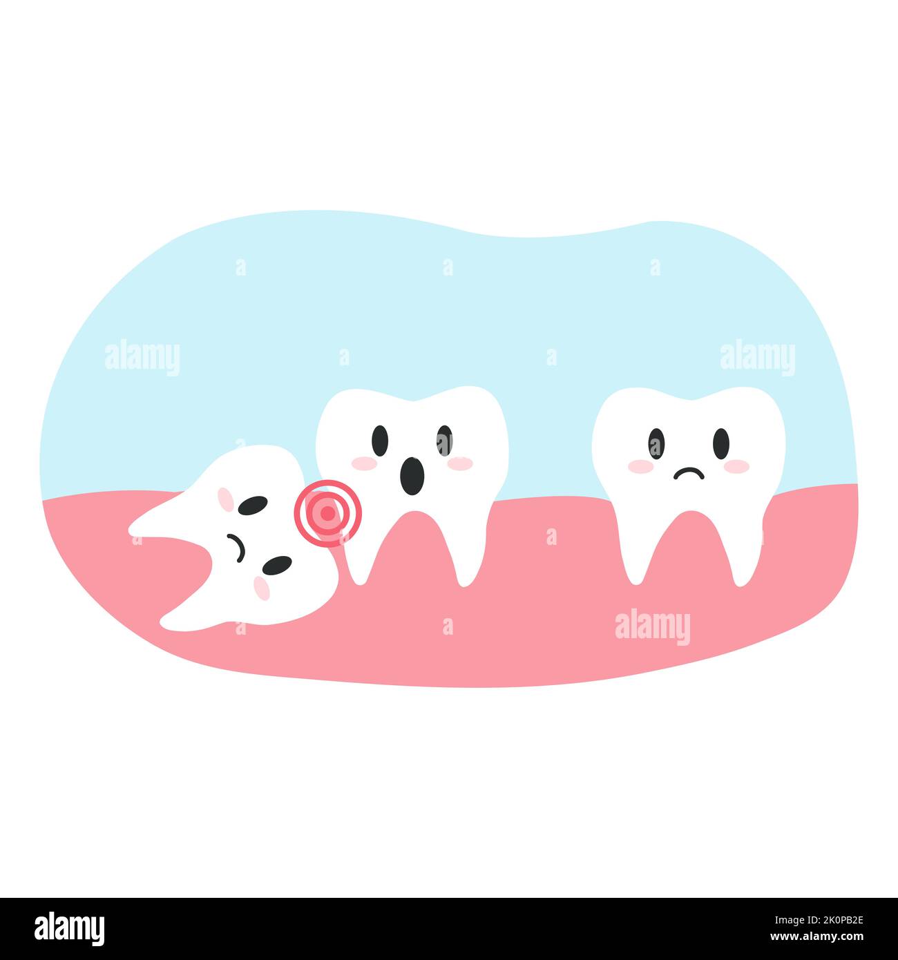 Impacted wisdom tooth in cartoon flat style. Vector illustration of ...