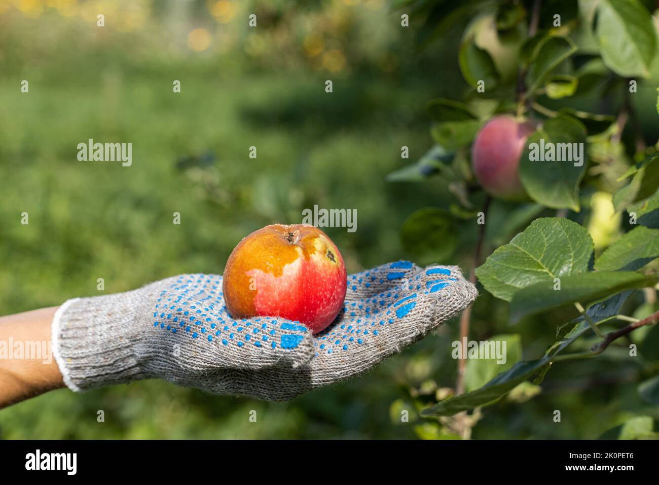 Leprosy hand hi-res stock photography and images - Alamy