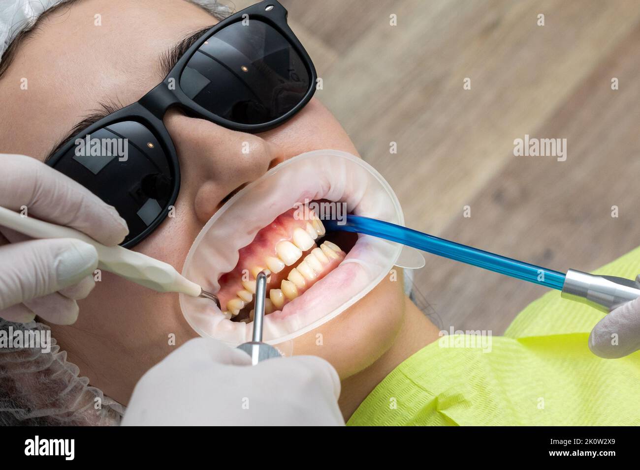 Patient with cheek retractor lying in dentist office Stock Photo - Alamy