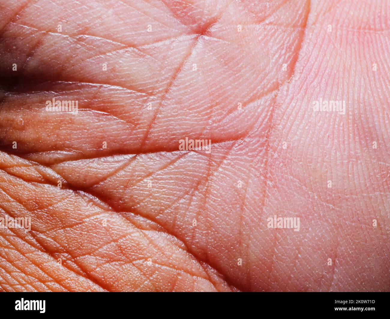 Close up of Human Skin Texture Stock Photo - Alamy
