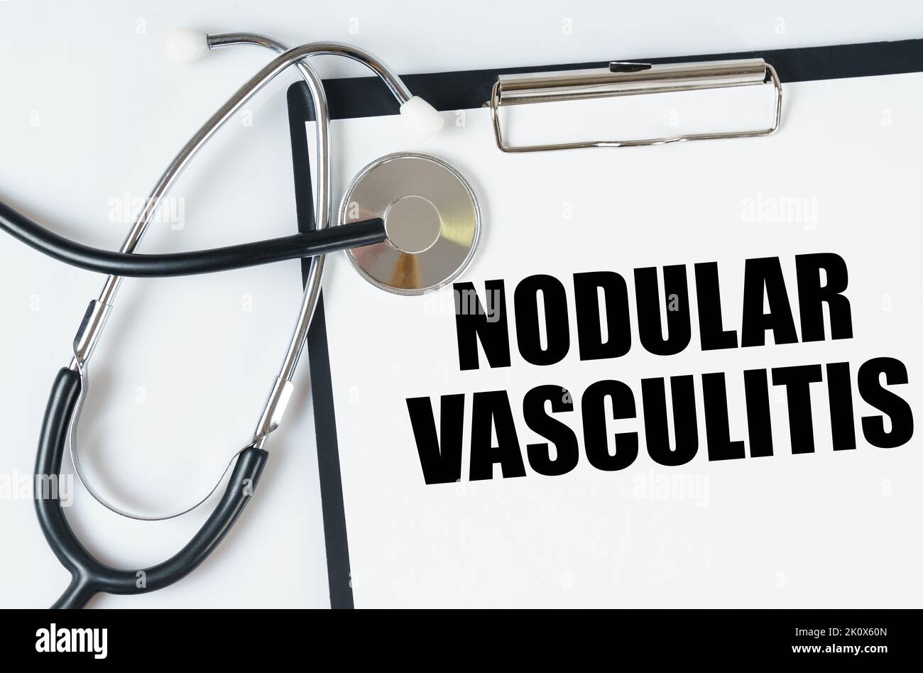 Medical concept. On a white surface, a stethoscope and a tablet with an ...