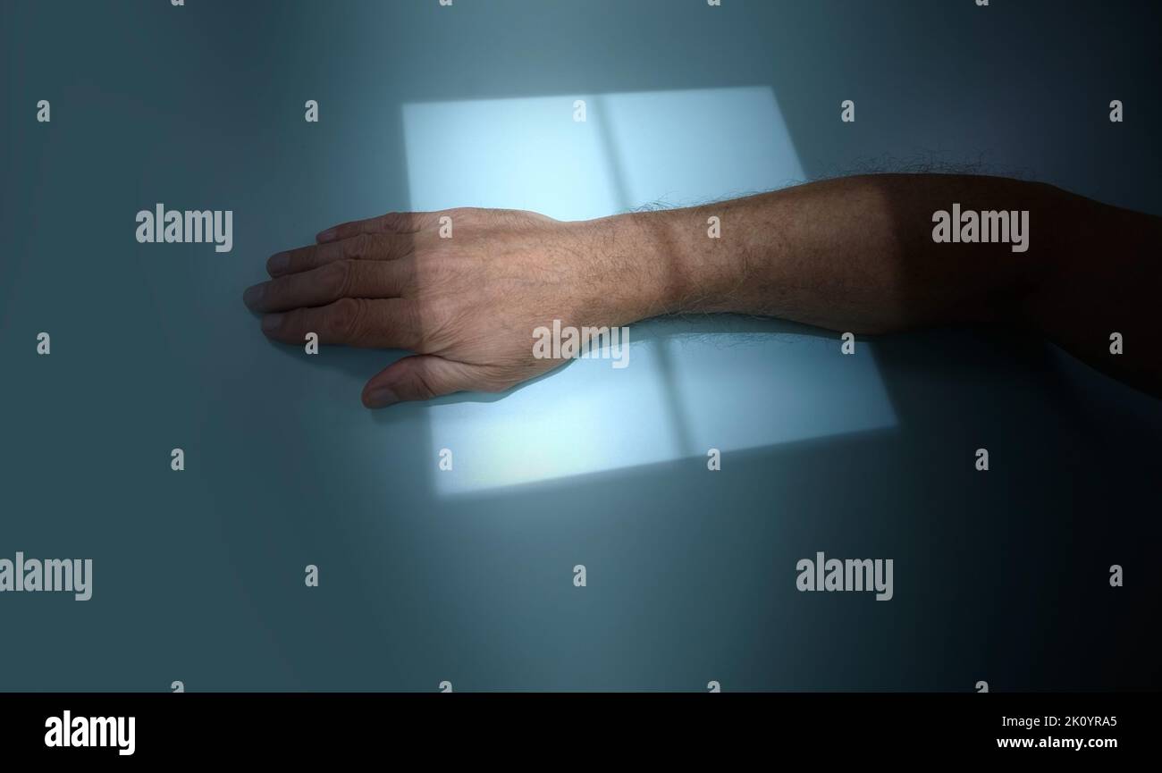 X-ray hand, close-up. patient with wrist injury during x-ray procedure ...