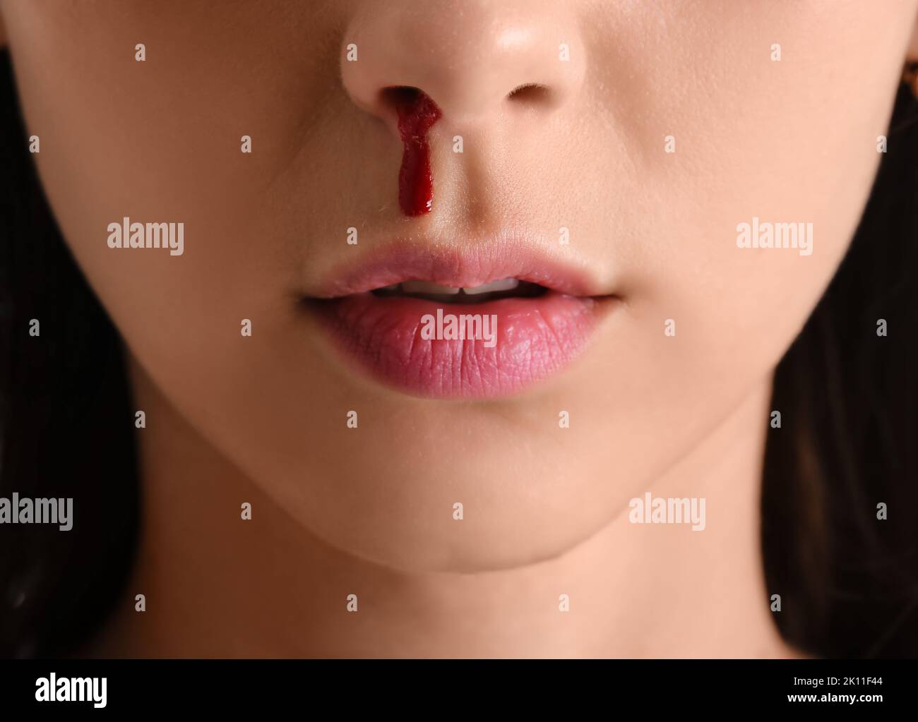 Girl with nosebleed hi-res stock photography and images - Alamy