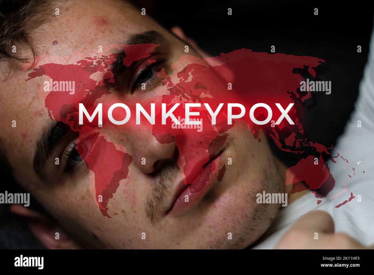 Man people virus. Monkeypox new disease dangerous over the world ...