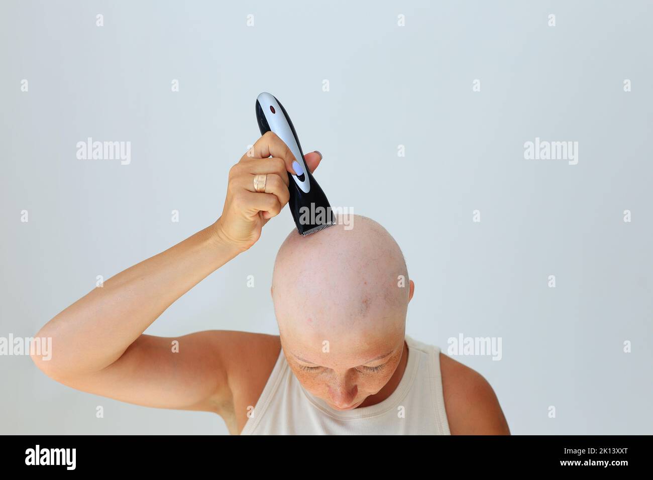 consequences of chemotherapy. Shaving off the last hair on the head ...