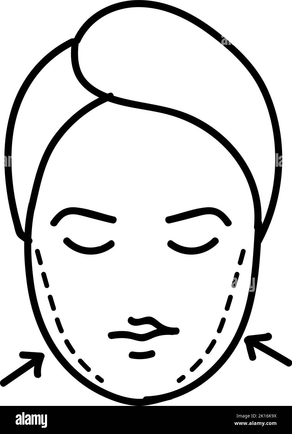Women beauty face plastic surgery. Cheeks augmentation. Hand drawn ...