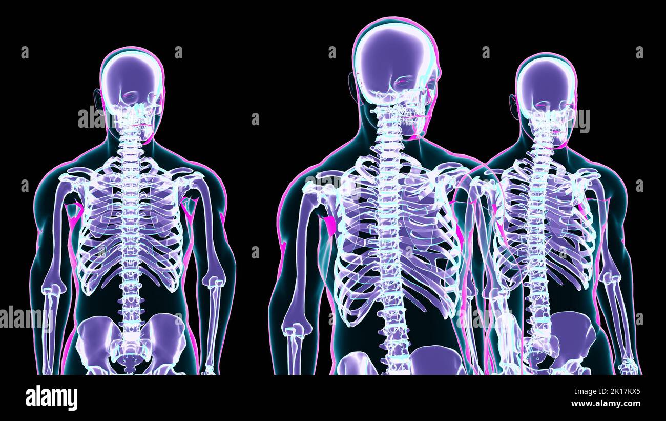 Three skeletons standing and moving normally isolated on black ...