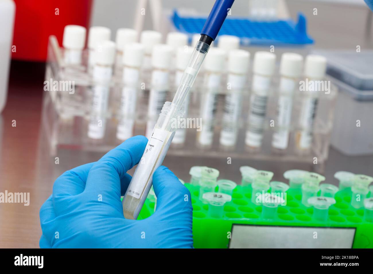 Closeup Of A Scientist Extracting Dna Using The Spin Column Based