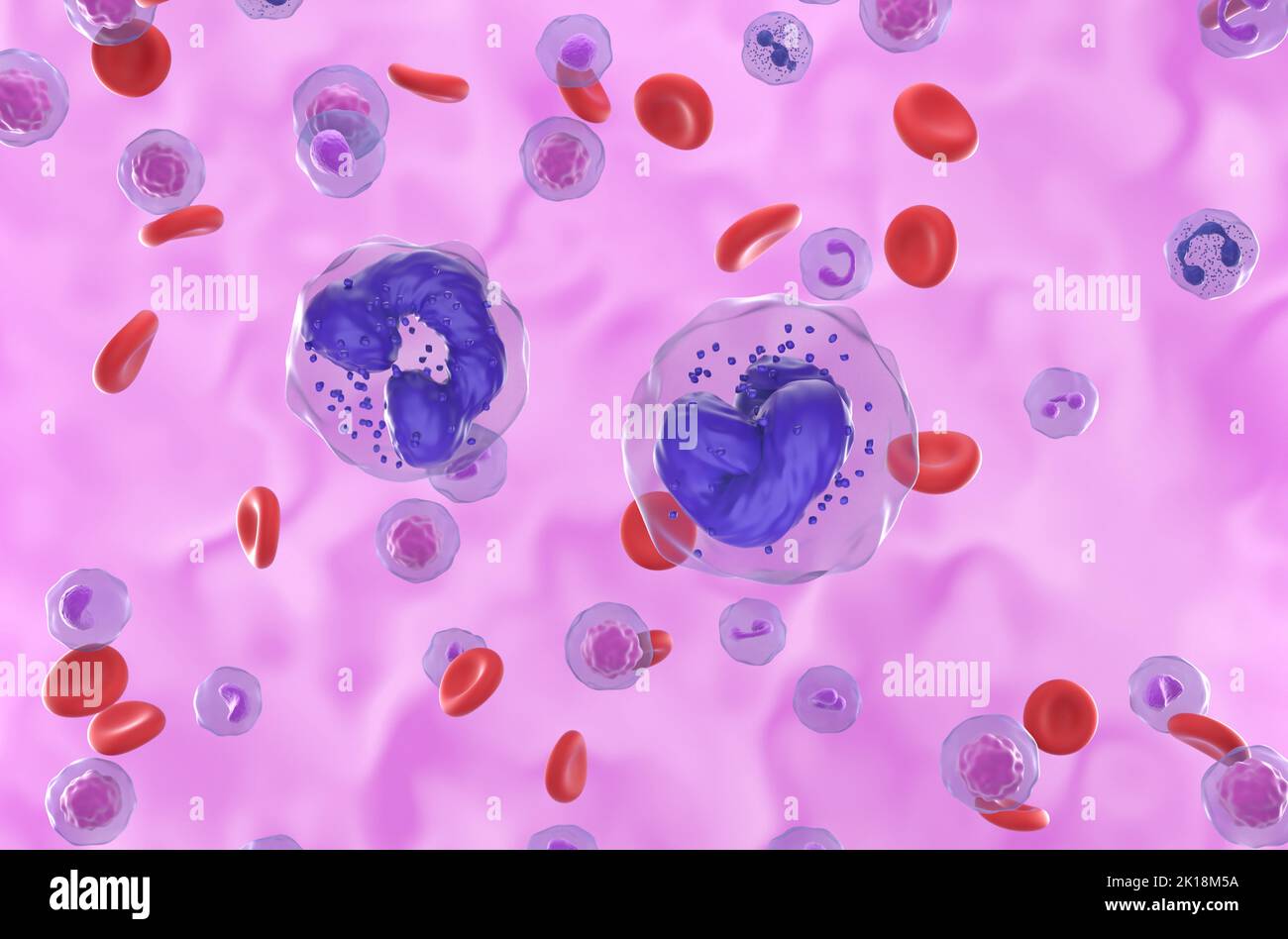 Chronic Myelogenous Leukemia (CML) cells in the blood flow - closeup ...