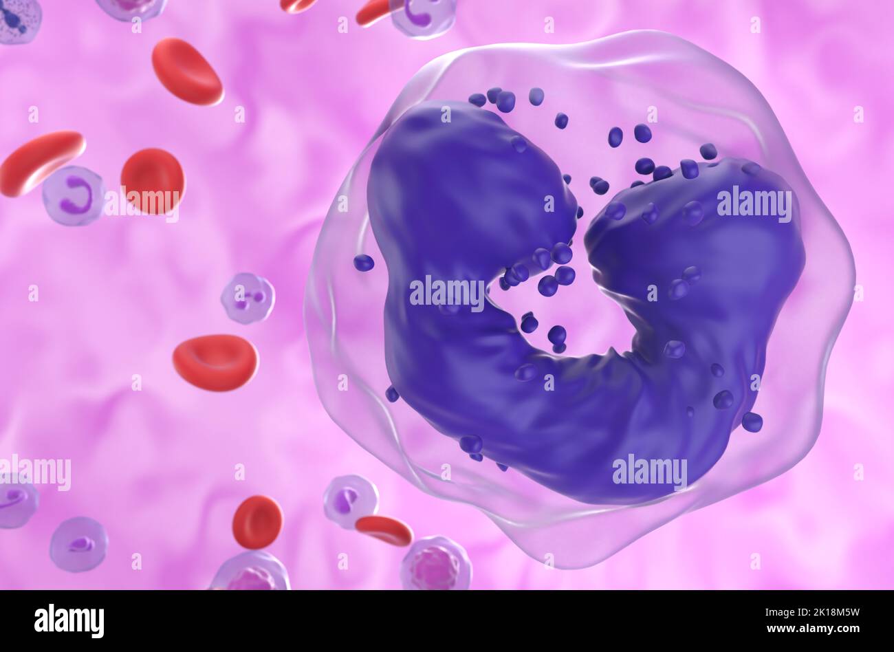 Chronic Myelogenous Leukemia (CML) cell in the blood flow - super ...